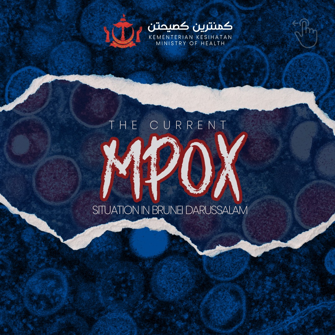 MPOX - Ministry of Health Brunei